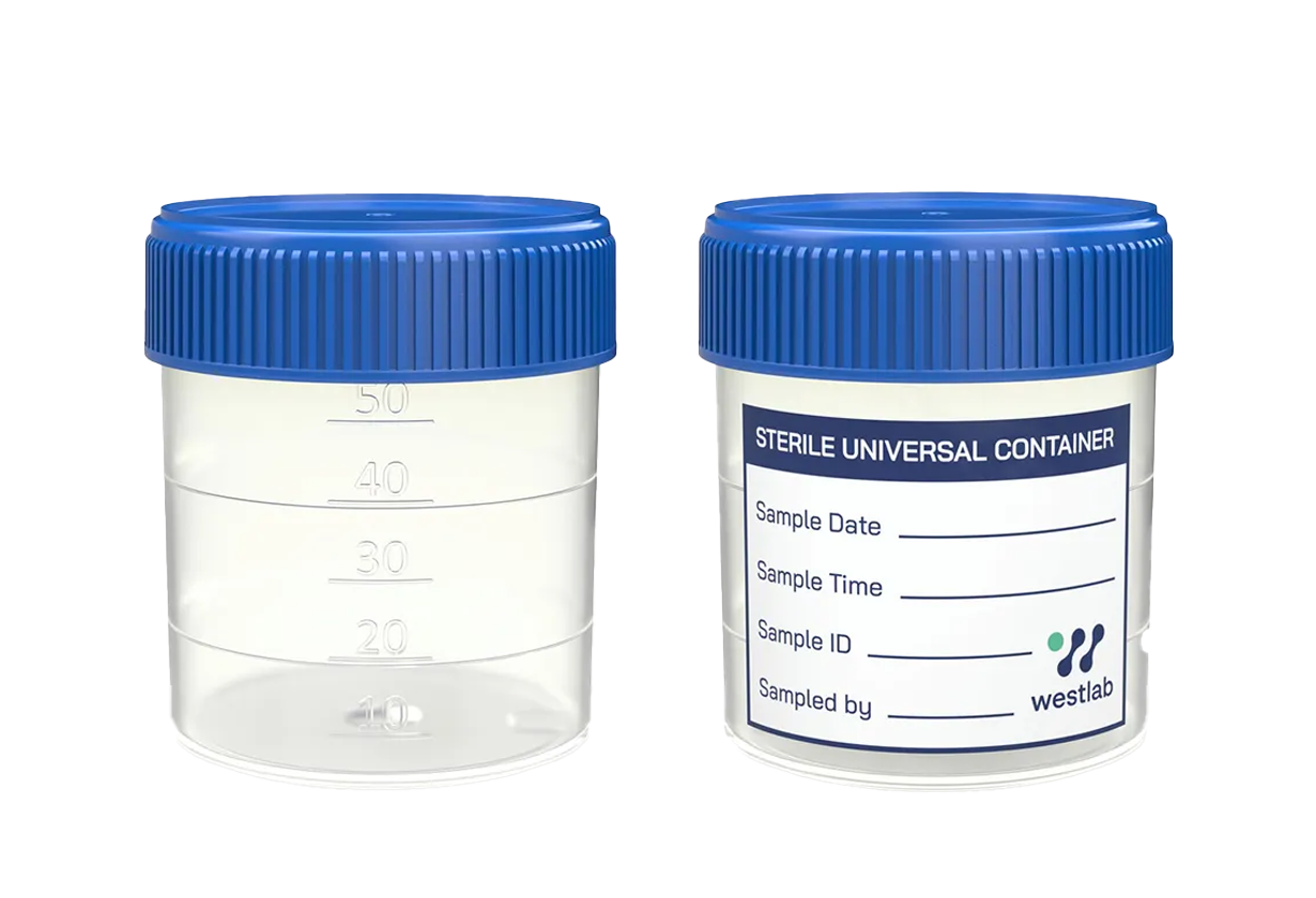 Sample Containers (urine, sputum, stool, etc.) - Aarvi Touch